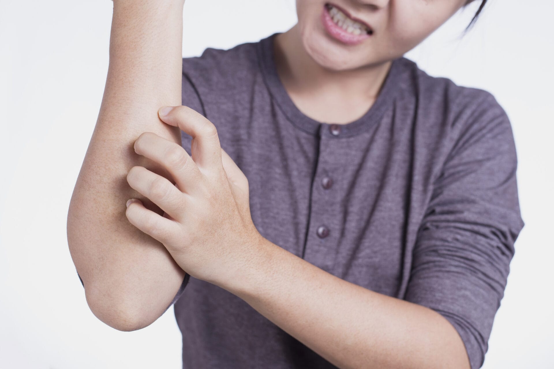 SKIN DISEASE | Houston Family Physicians PA